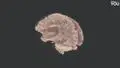 Visualizing the Human Brain 11th Grade - University Video | Wayground