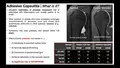 Adhesive Capsulitis (Frozen Shoulder) | Part 1 - Presentation ...