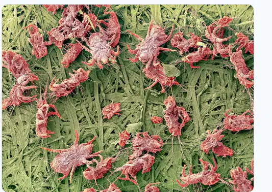 What is this magnified object? Quiz