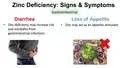 Zinc Deficiency Signs & Symptoms (ex. Hair Loss, Acne, Infections ...