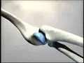 The Importance of Cartilage in the Skeletal System Interactive Video