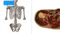 Cross sections of the upper extremity: Shoulder level Interactive Video