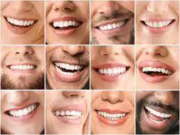 Guess the Celebrity Smile Quiz